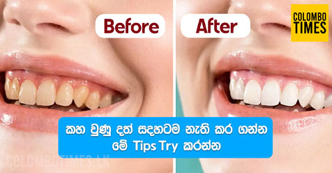 VIDEO | කහ වුණු දත් සදහටම නැති කර ගන්න මේ Tips Try කරන්න